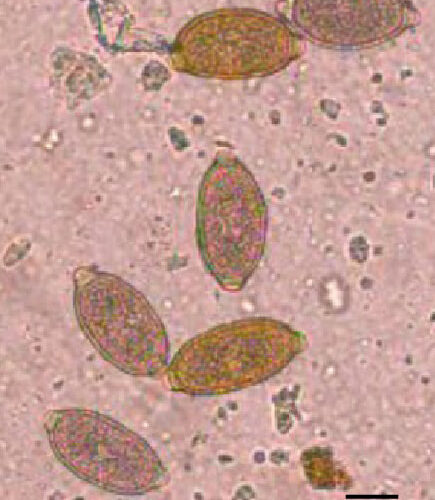 Capillaria Aerophila (Lung Hairworm): Parasitic Infection in Domestic ...